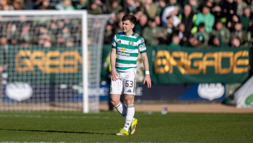 Kieran Tierney Injury Update - Celts Are Here - 25 Apr